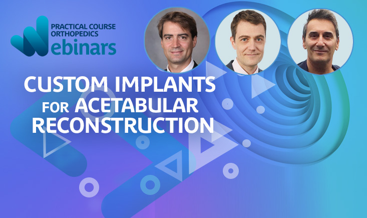 Custom implants for acetabular reconstruction | Practical Course ...
